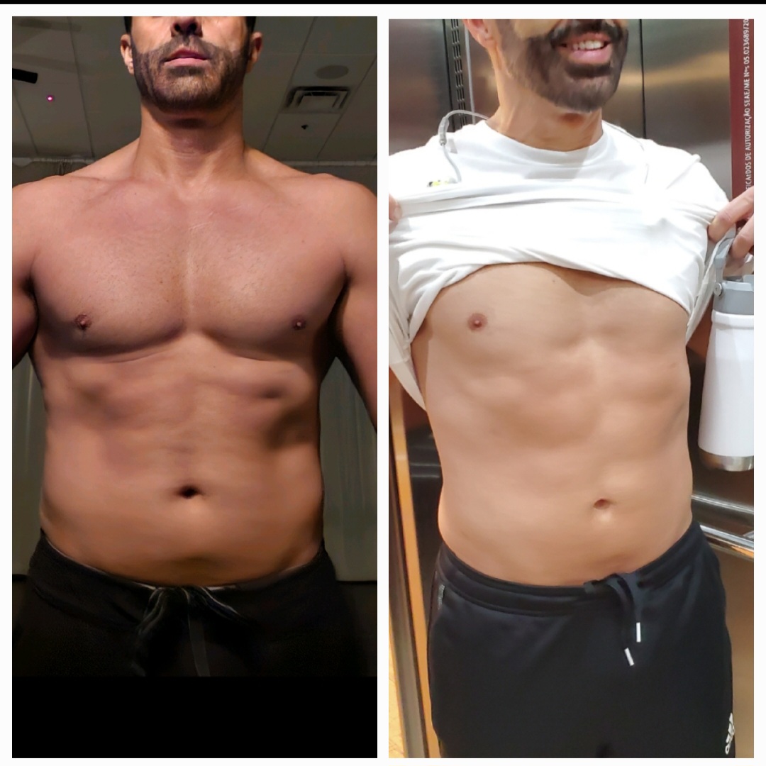 Glamour SilhoLine Slim solution lipolytic 10ml*5 FAST RESULT - Labode Beauty